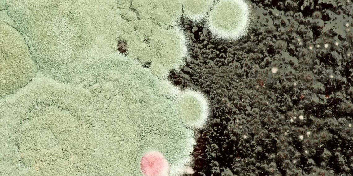 Aspergillosis Explained: Types, Symptoms, and Who’s at Risk – Moldfear.com
